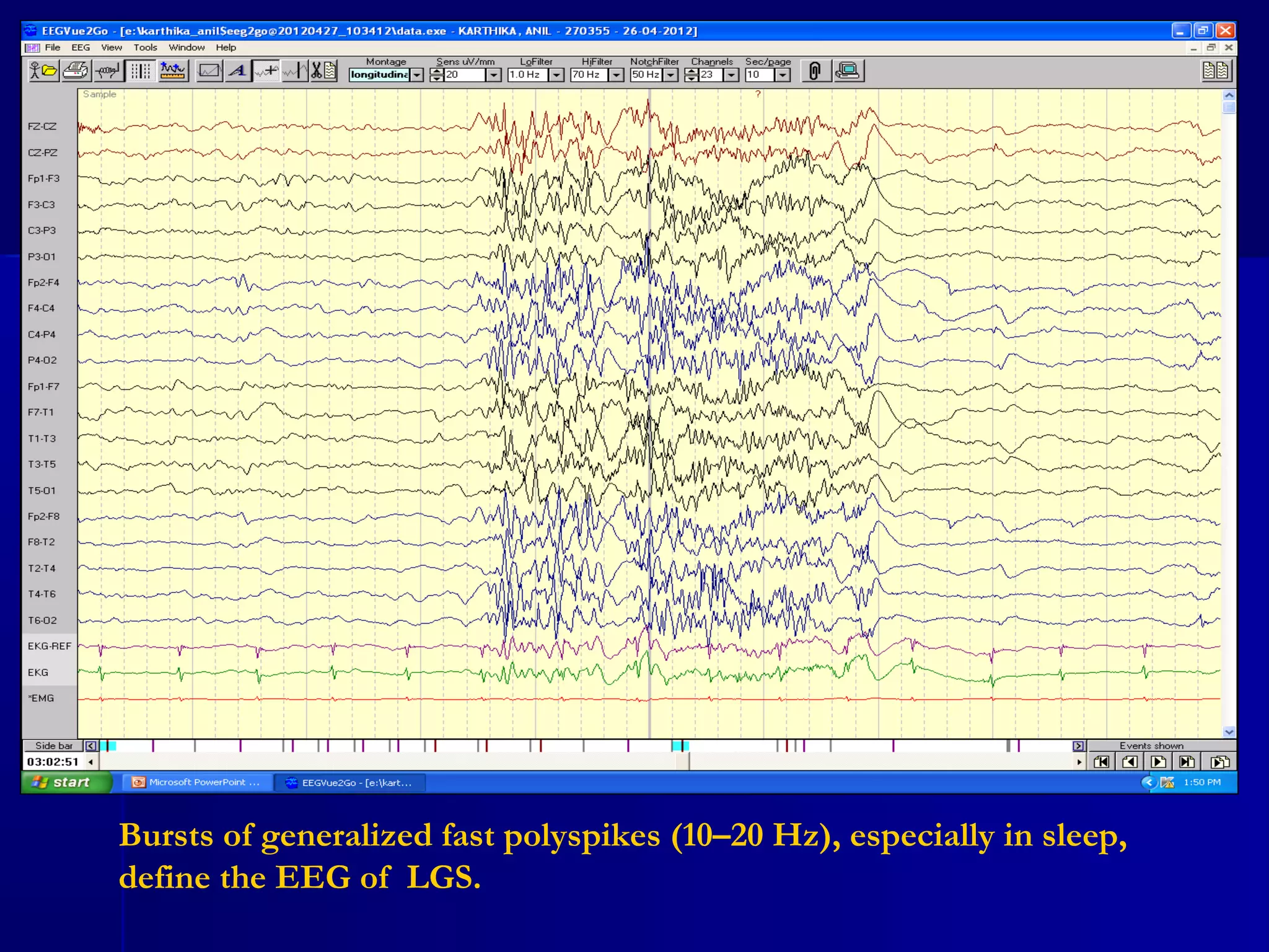 Pediatric posterior head region epilepsy | PPT