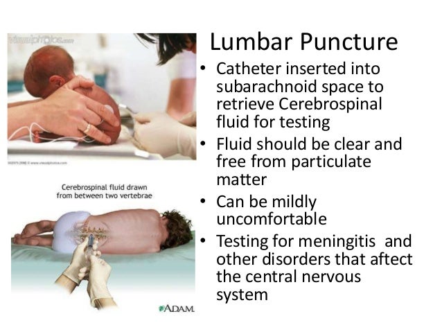 Pediatric Term Review