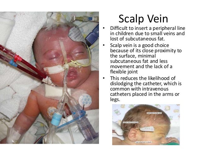 Pediatric Term Review