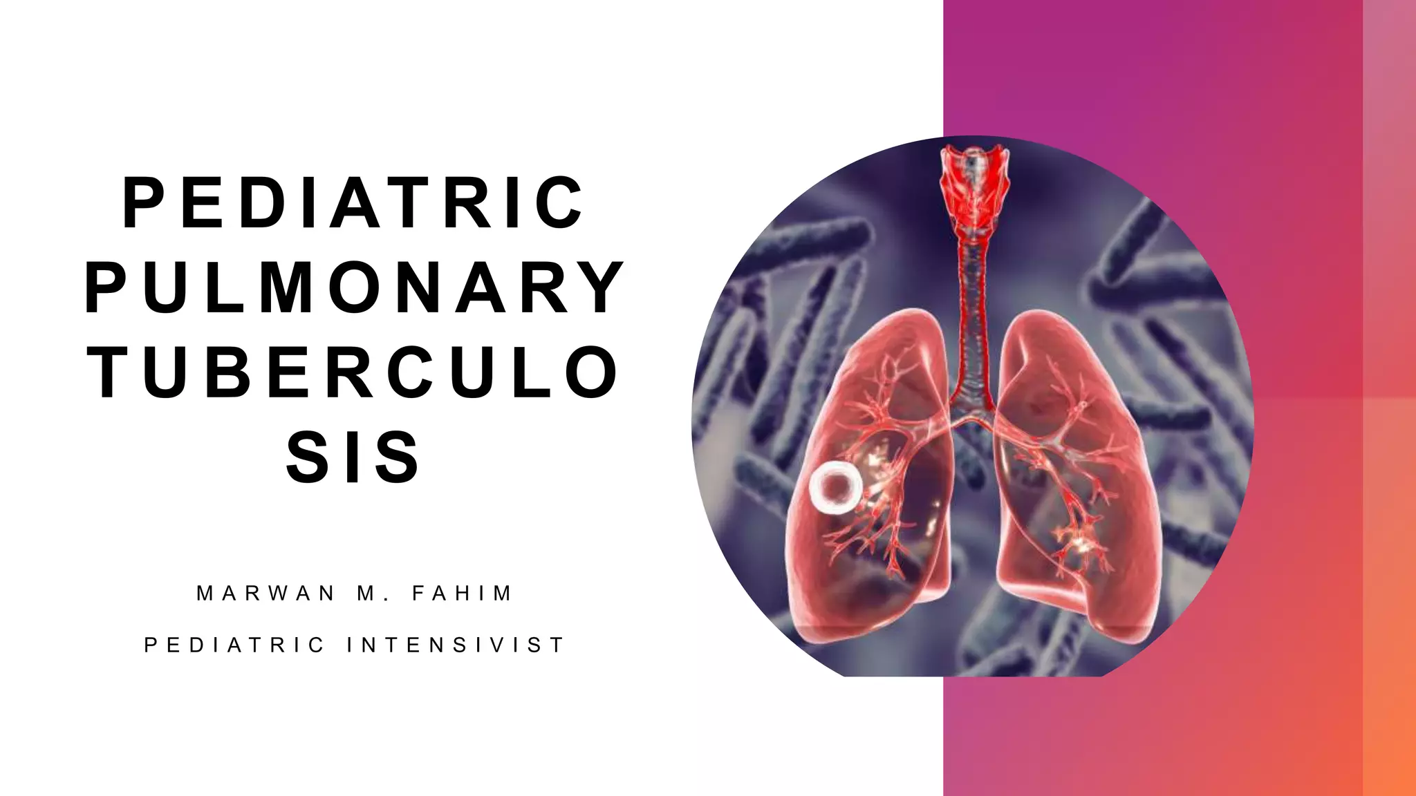 Pediatric Pulmonary Tuberculosis | PPTX