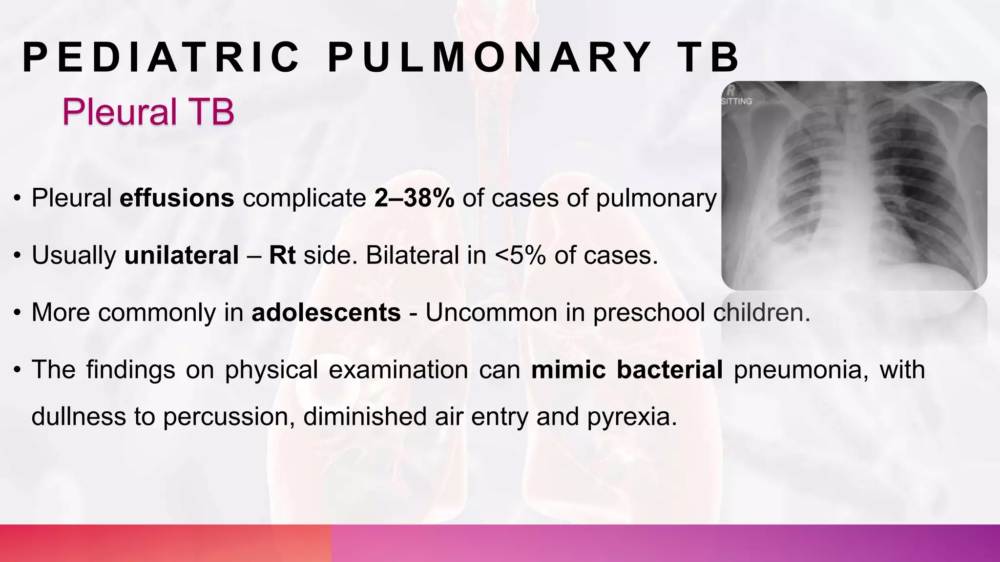 Pediatric Pulmonary Tuberculosis | PPTX