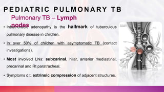 Pediatric Pulmonary Tuberculosis | PPTX