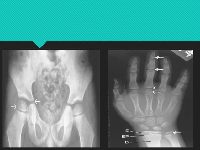 PEDIATRIC RADIOGRAPHY.pptx | First Aid | Injuries