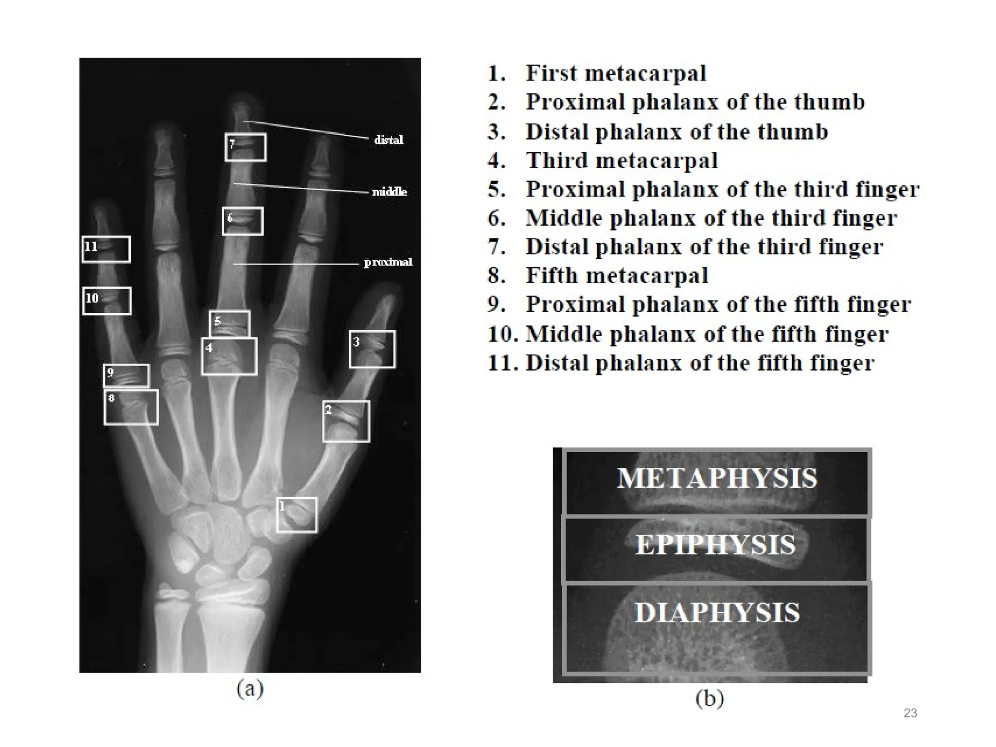 PEDIATRIC RADIOGRAPHY MEDICAL IMAGING.ppt