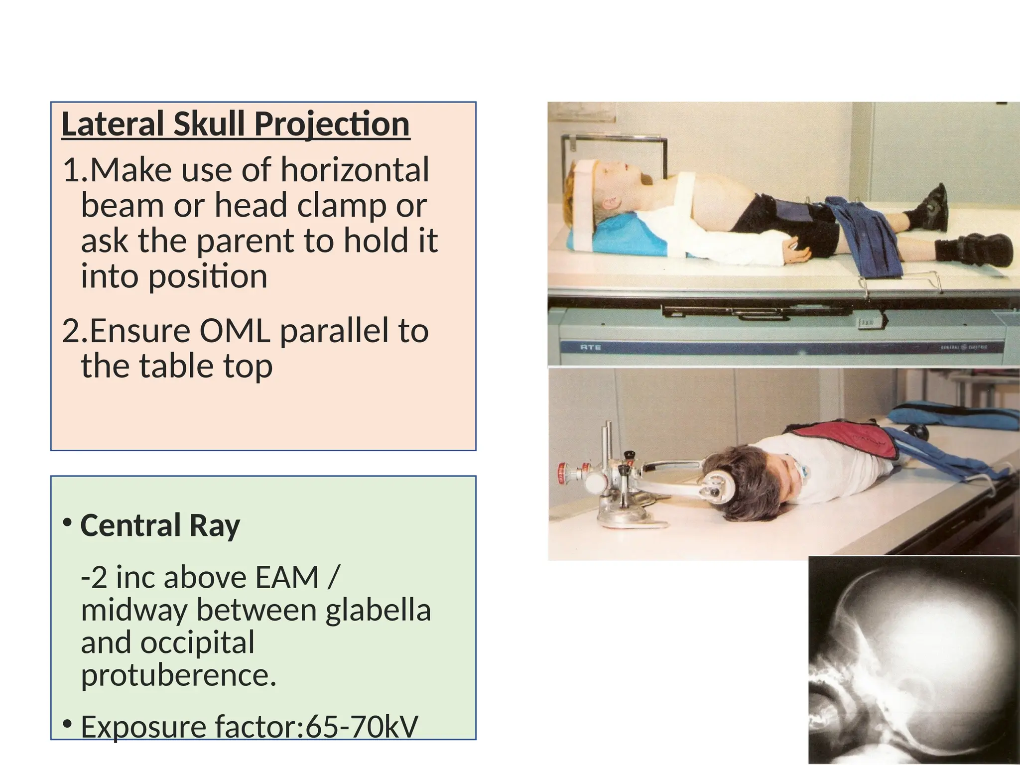 PEDIATRIC RADIOGRAPHY MEDICAL IMAGING.ppt