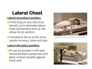 PEDIATRIC RADIOGRAPHY MEDICAL IMAGING.ppt