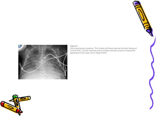Pediatric radiology | PPTX