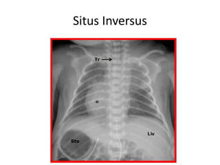 pediatric radiology.pptx