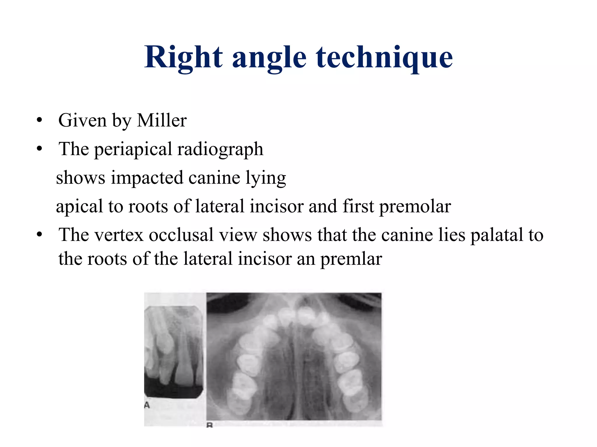 Radiology in Pediatric Dentistry | PPTX