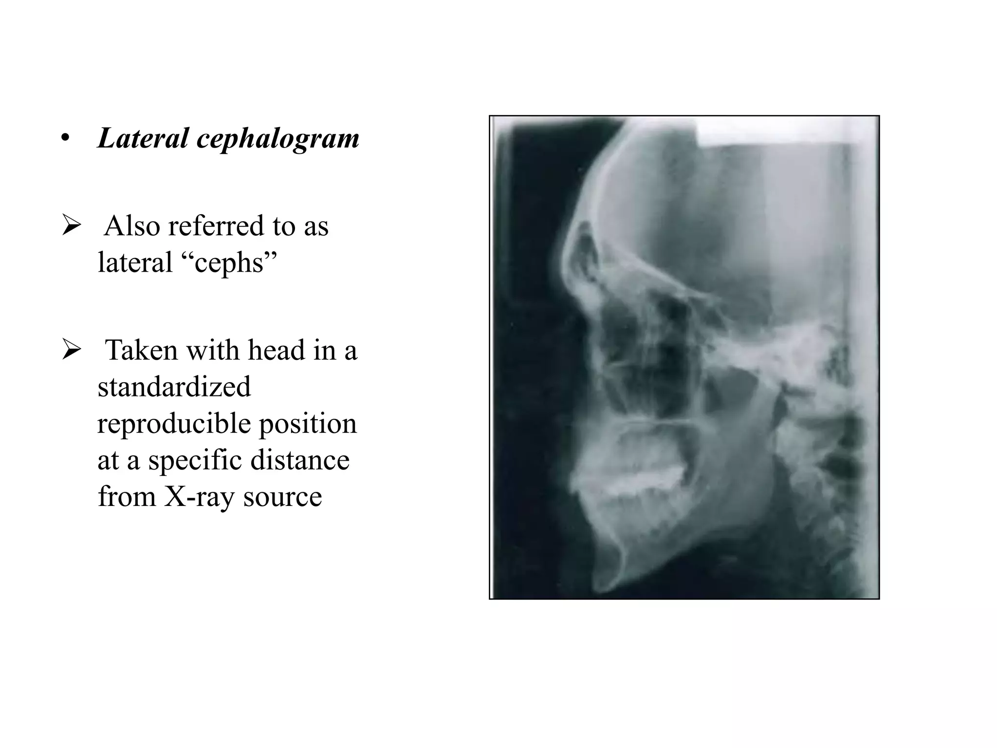 Radiology in Pediatric Dentistry | PPTX