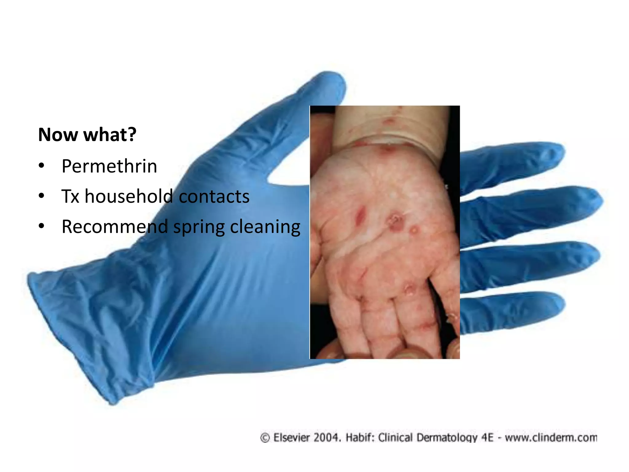 Pediatric rashes | PPTX