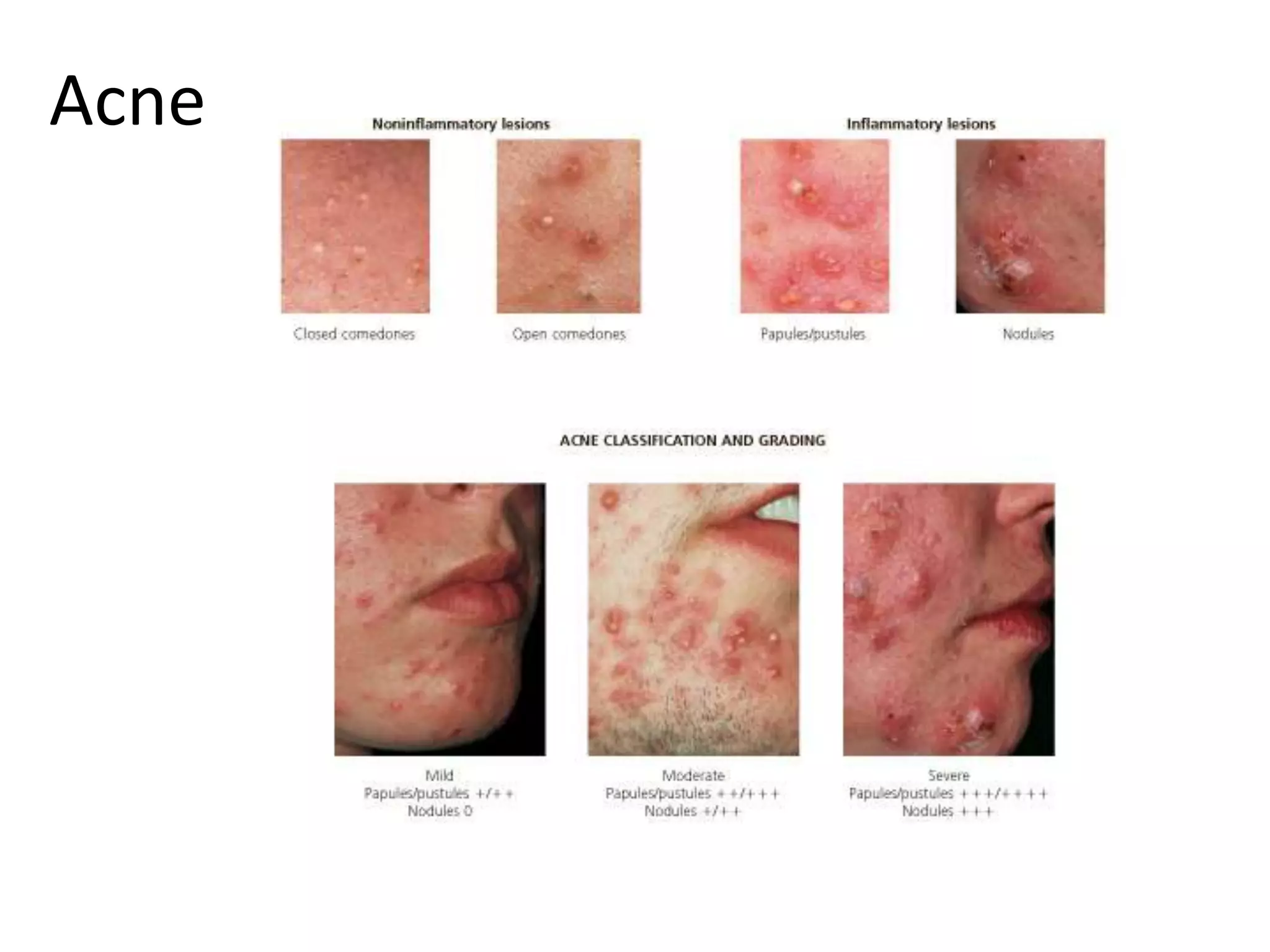Pediatric rashes | PPTX