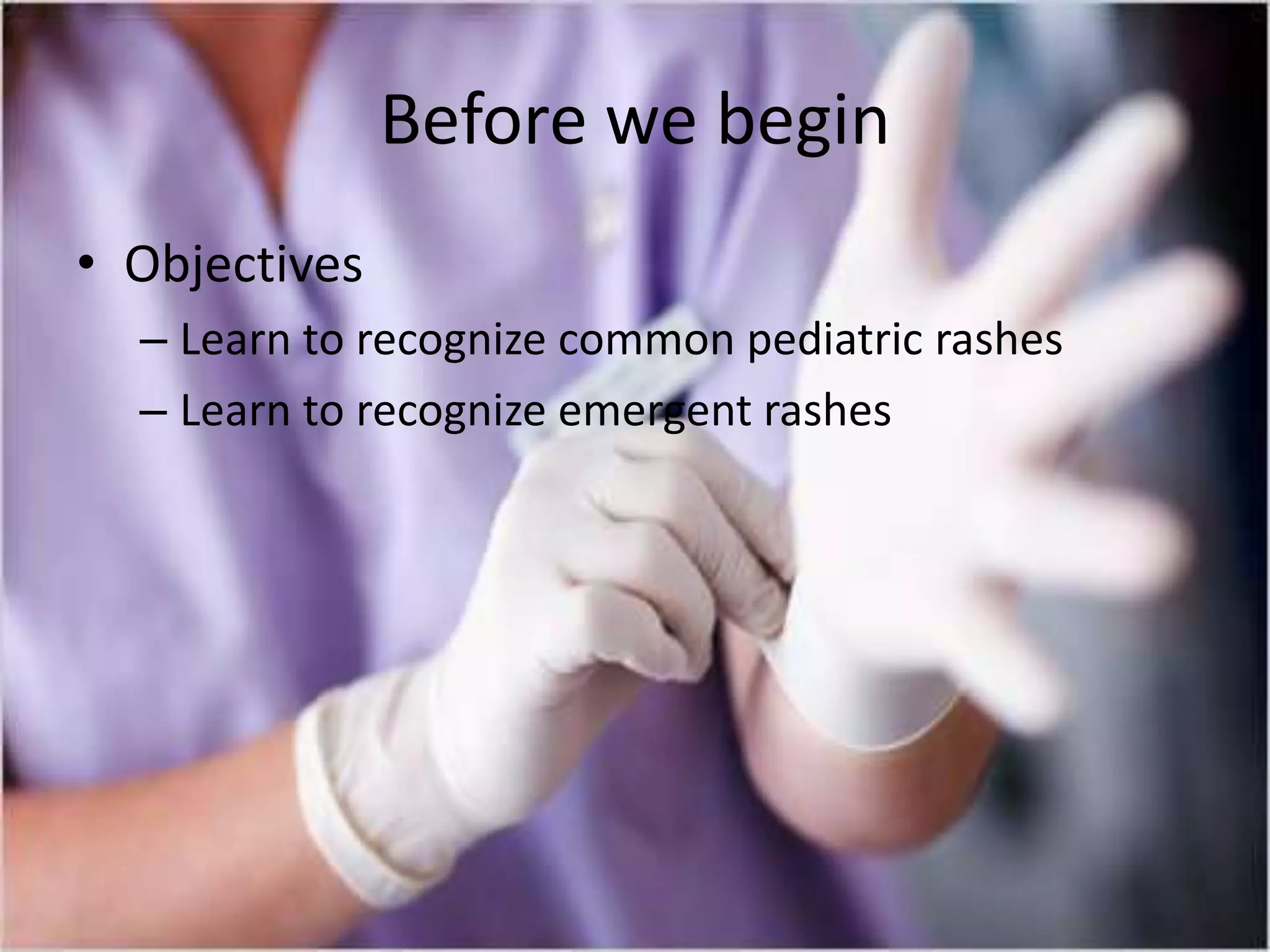 Pediatric rashes | PPTX