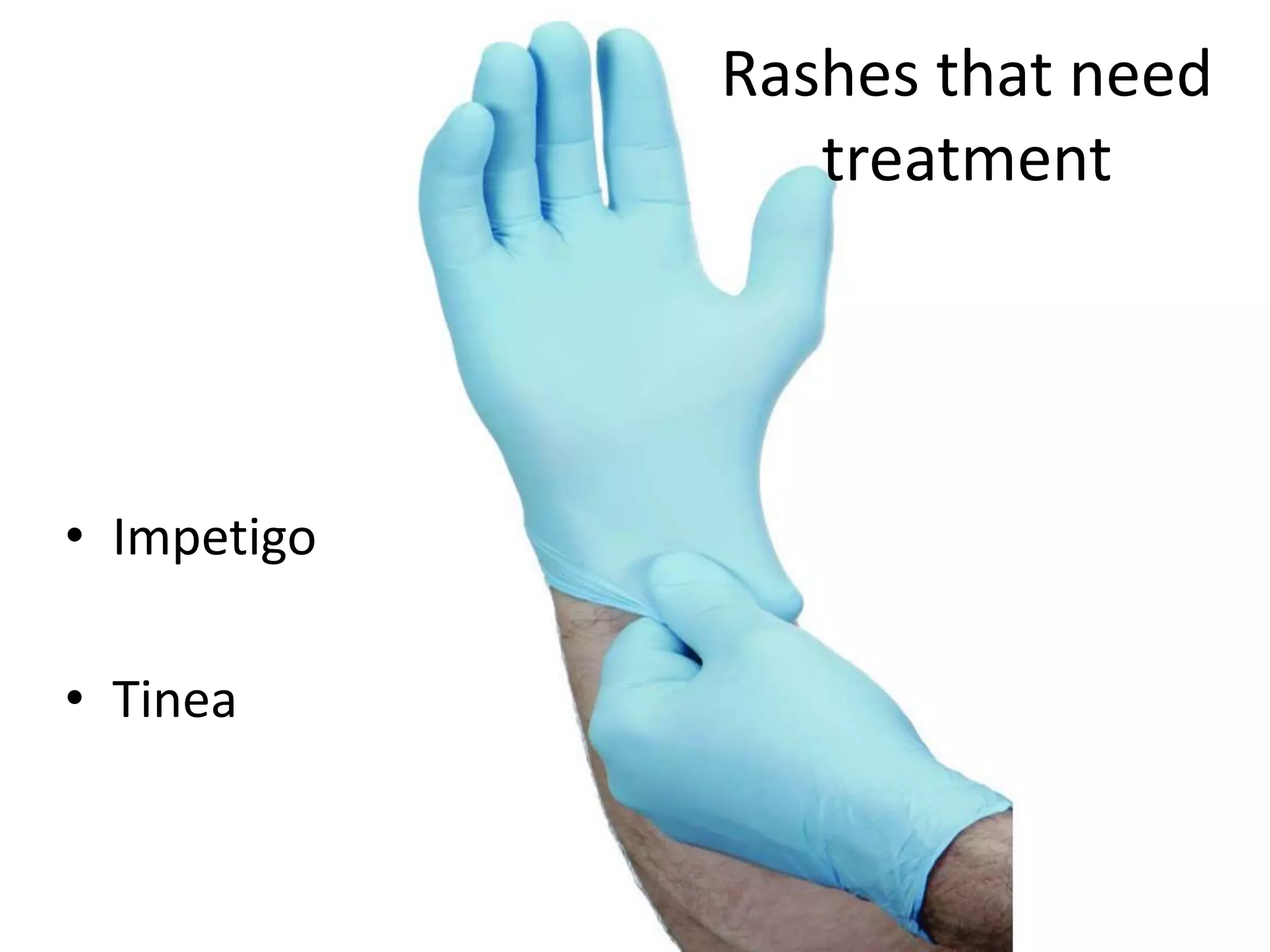 Pediatric rashes | PPTX
