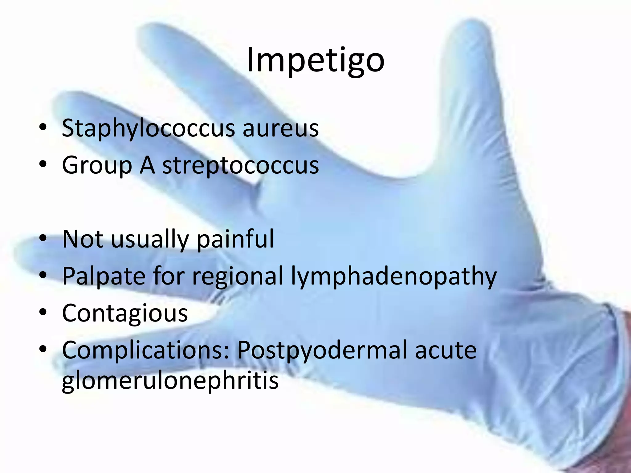 Pediatric rashes | PPTX