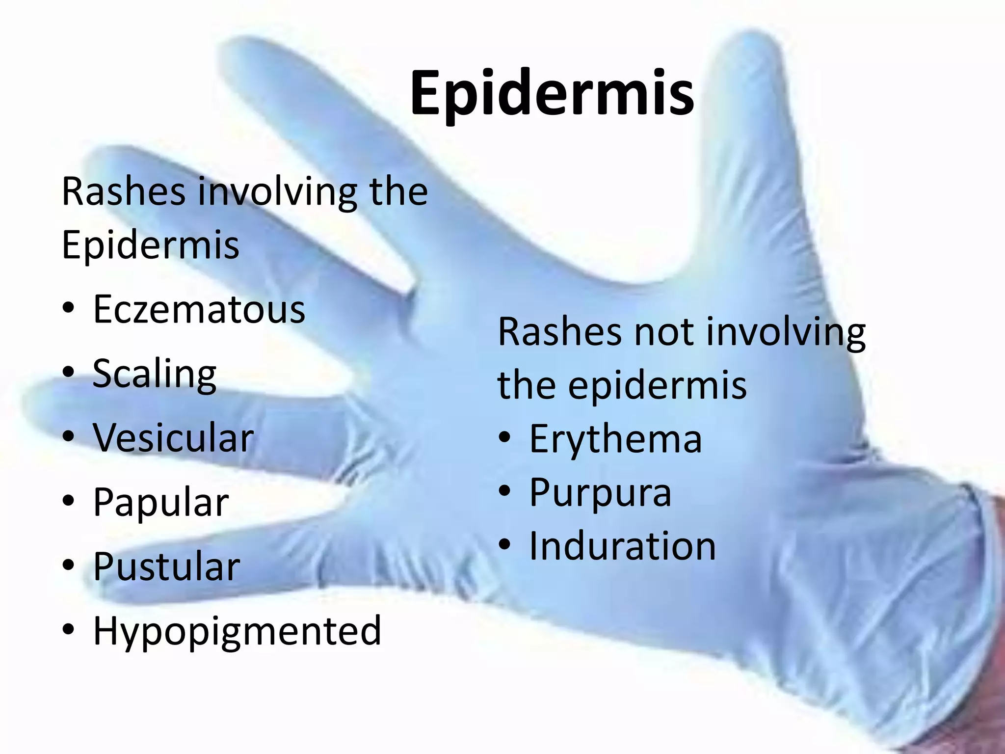 Pediatric rashes | PPTX