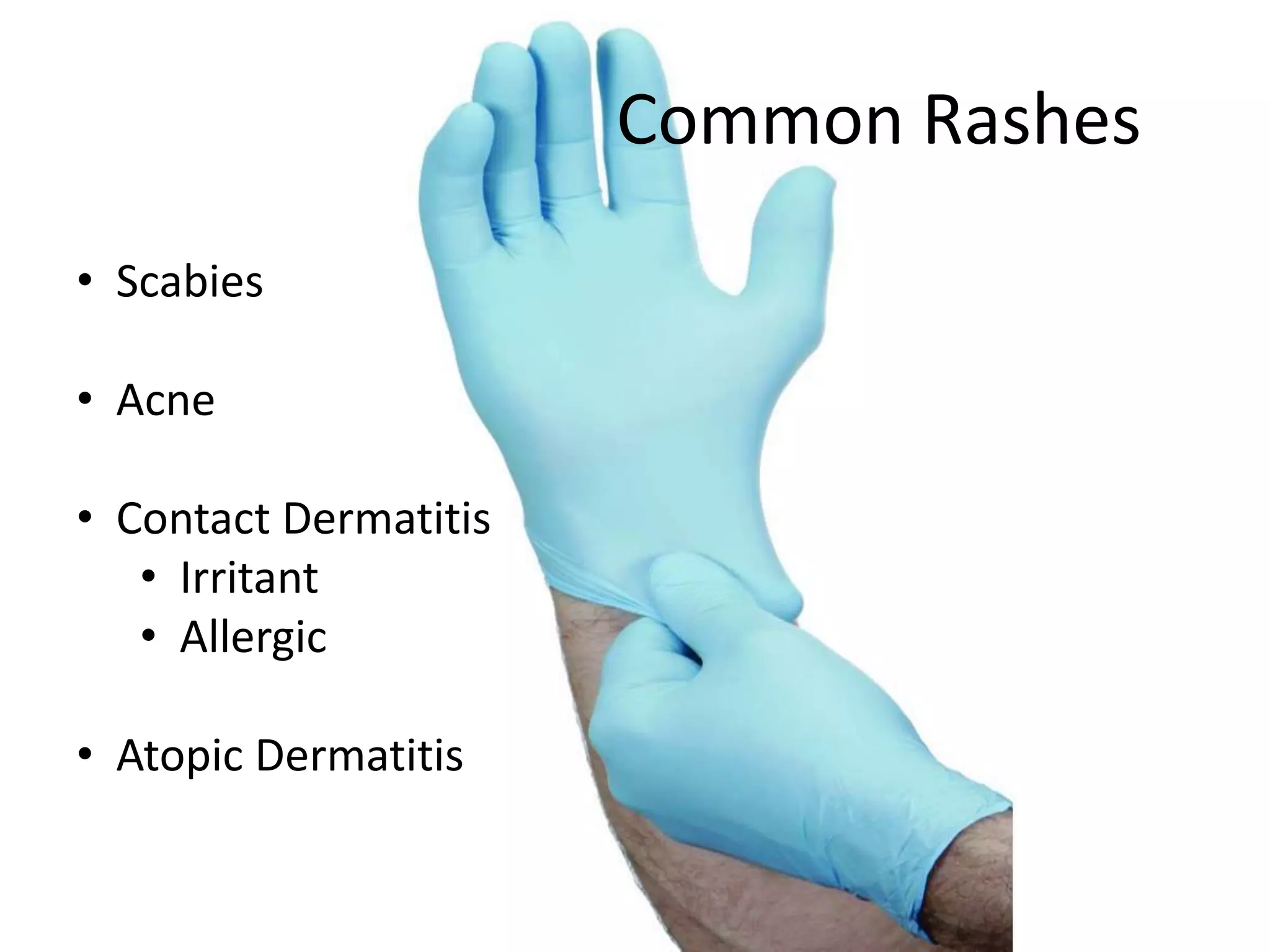 Pediatric rashes | PPTX