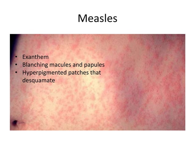 Pediatric rashes