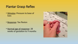 Expectd Pediatric Reflexes and Reactions | PPTX