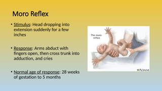 Expectd Pediatric Reflexes and Reactions | PPTX