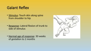 Expectd Pediatric Reflexes and Reactions | PPTX