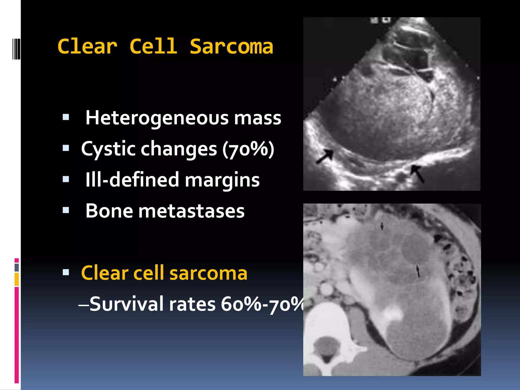Pediatric renal tumors radiology | PPTX