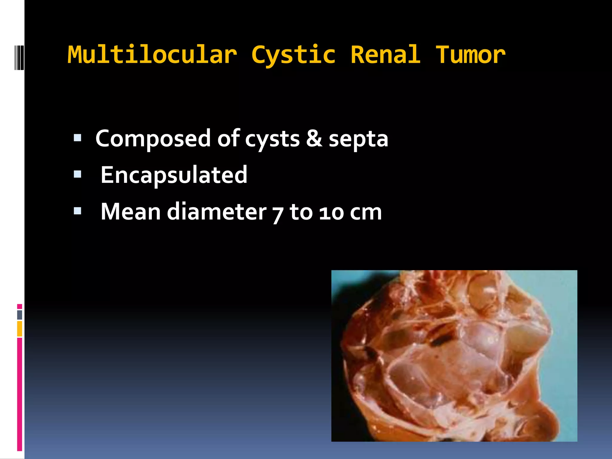 Pediatric renal tumors radiology | PPTX