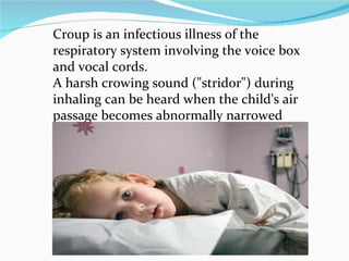 Pediatric respiratory | PPT