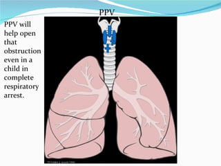 Pediatric respiratory | PPT