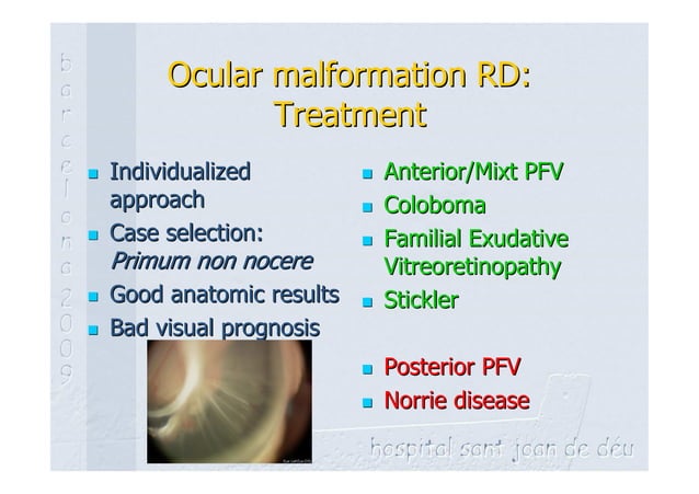 Pediatric retinal detachment | PDF