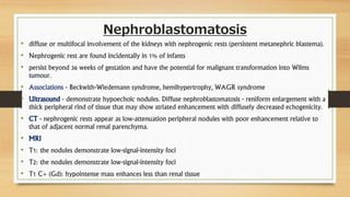 Imaging in Pediatric Retroperitoneal Masses | PPTX | Medical Health