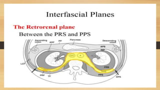 Imaging in Pediatric Retroperitoneal Masses | PPTX