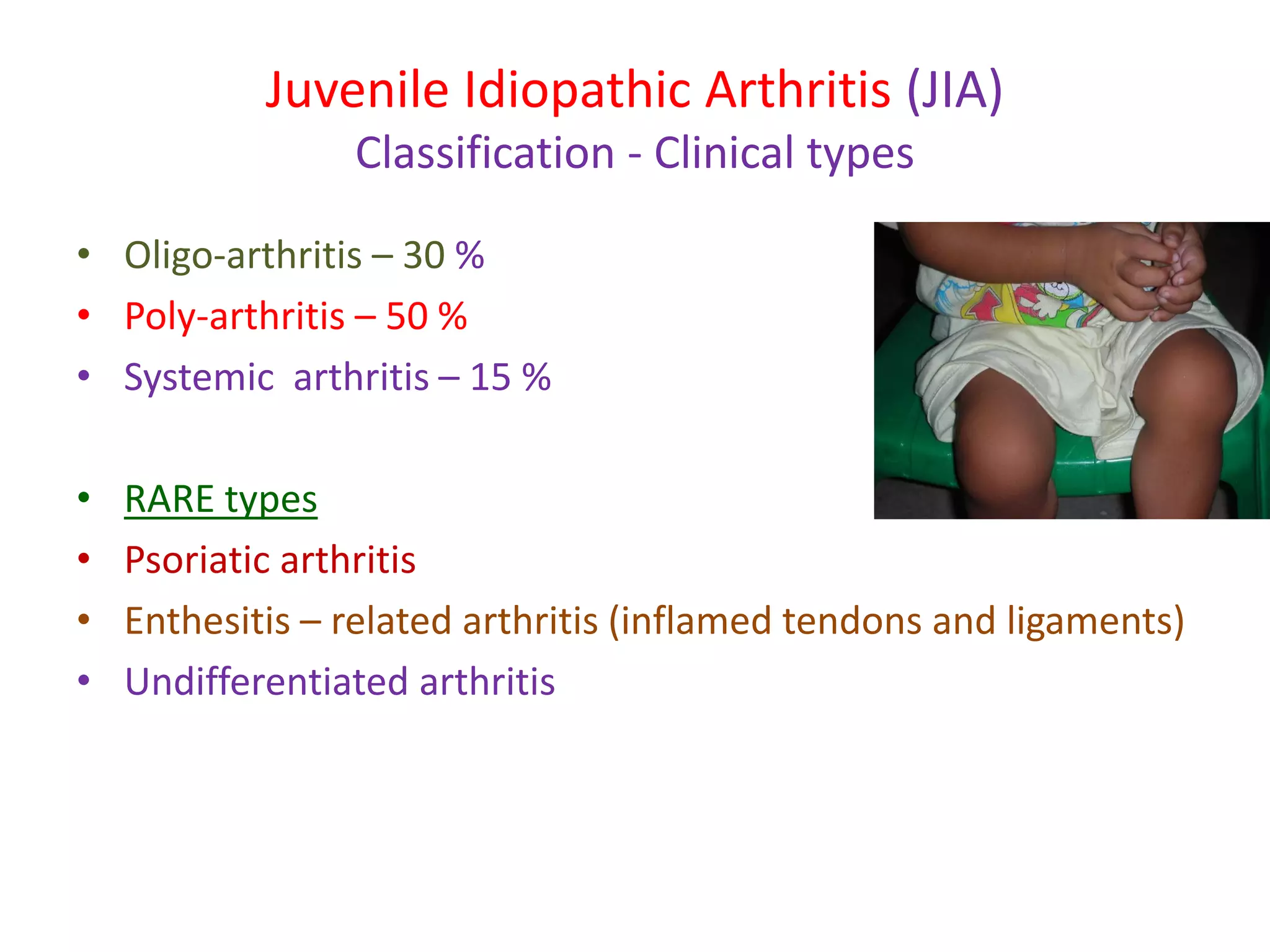 Pediatric rheumatology 2021 | PDF