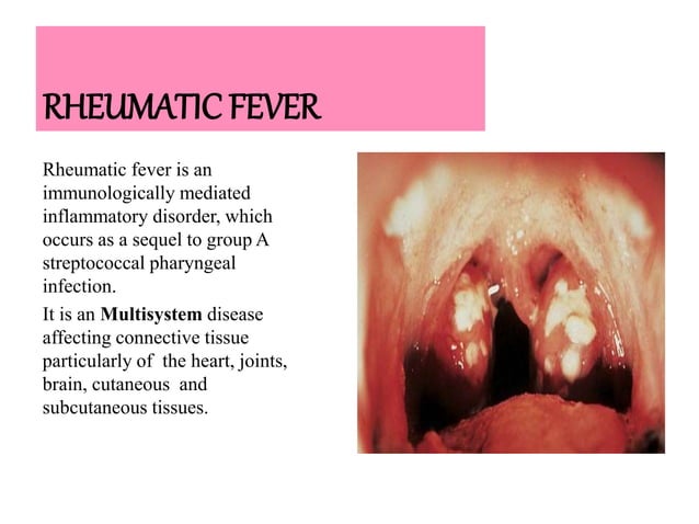 Rheumatic fever | PPT
