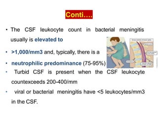 Review of Meningitis | PPTX