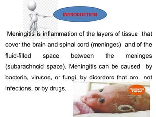 Review of Meningitis | PPTX