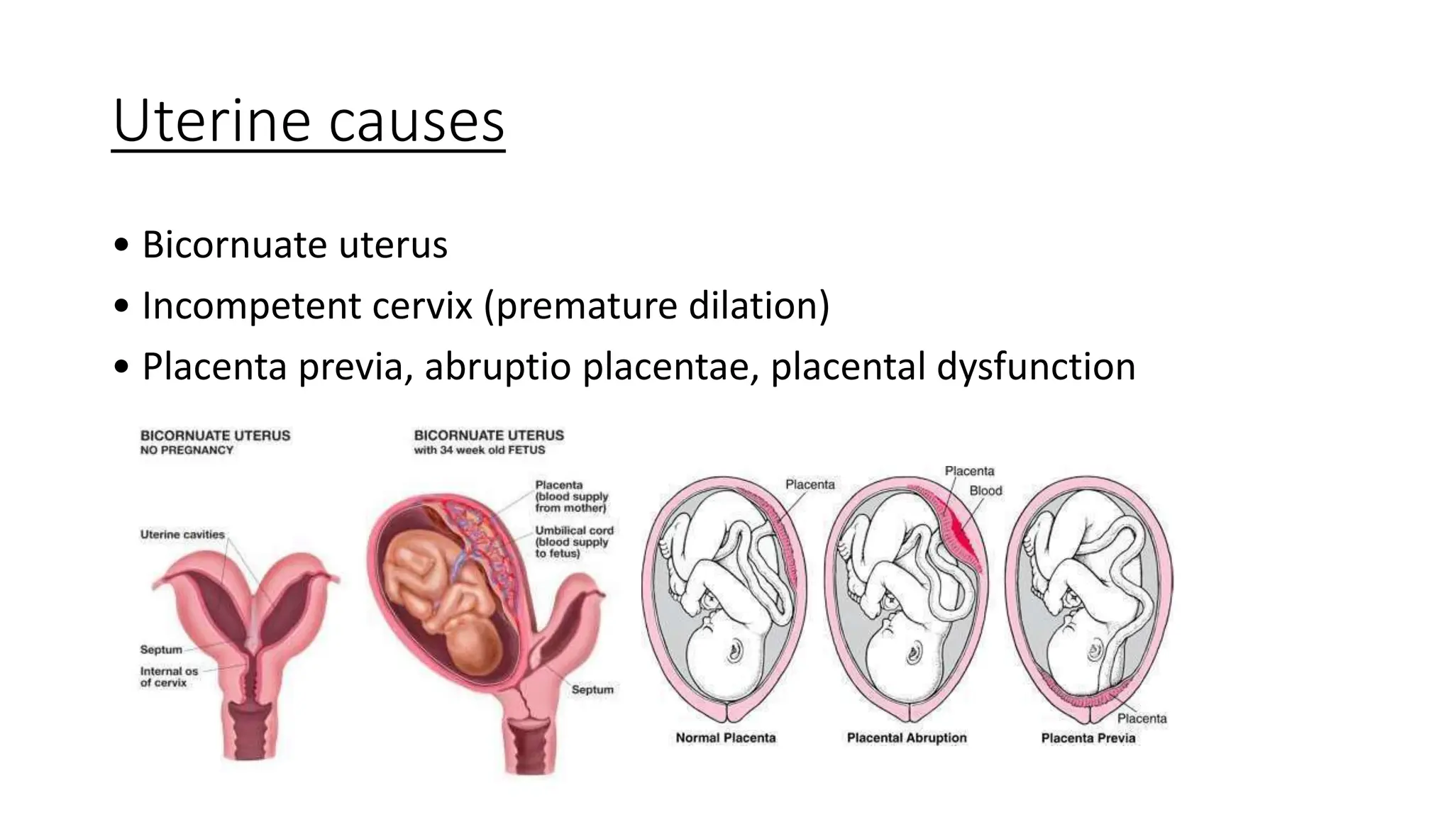 complications of preterm birth pediatrics 2.pptx