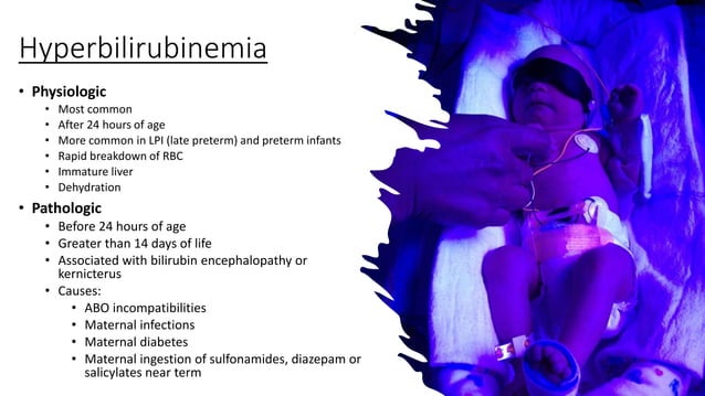 complications of preterm birth pediatrics 2.pptx