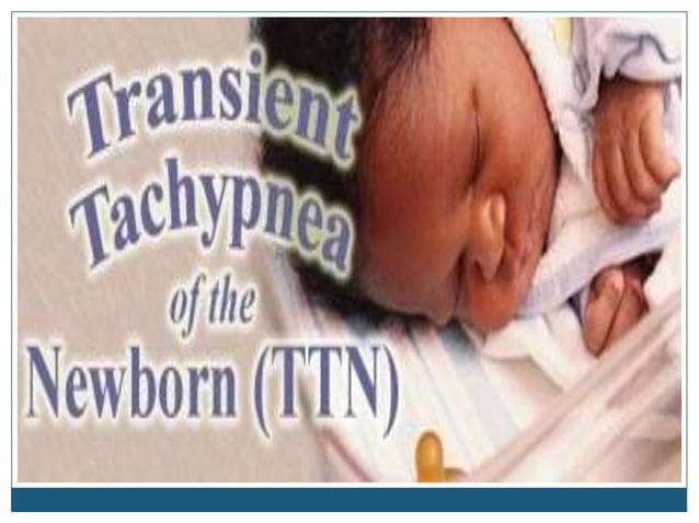 complications in newborn pediatrics 3.ppt