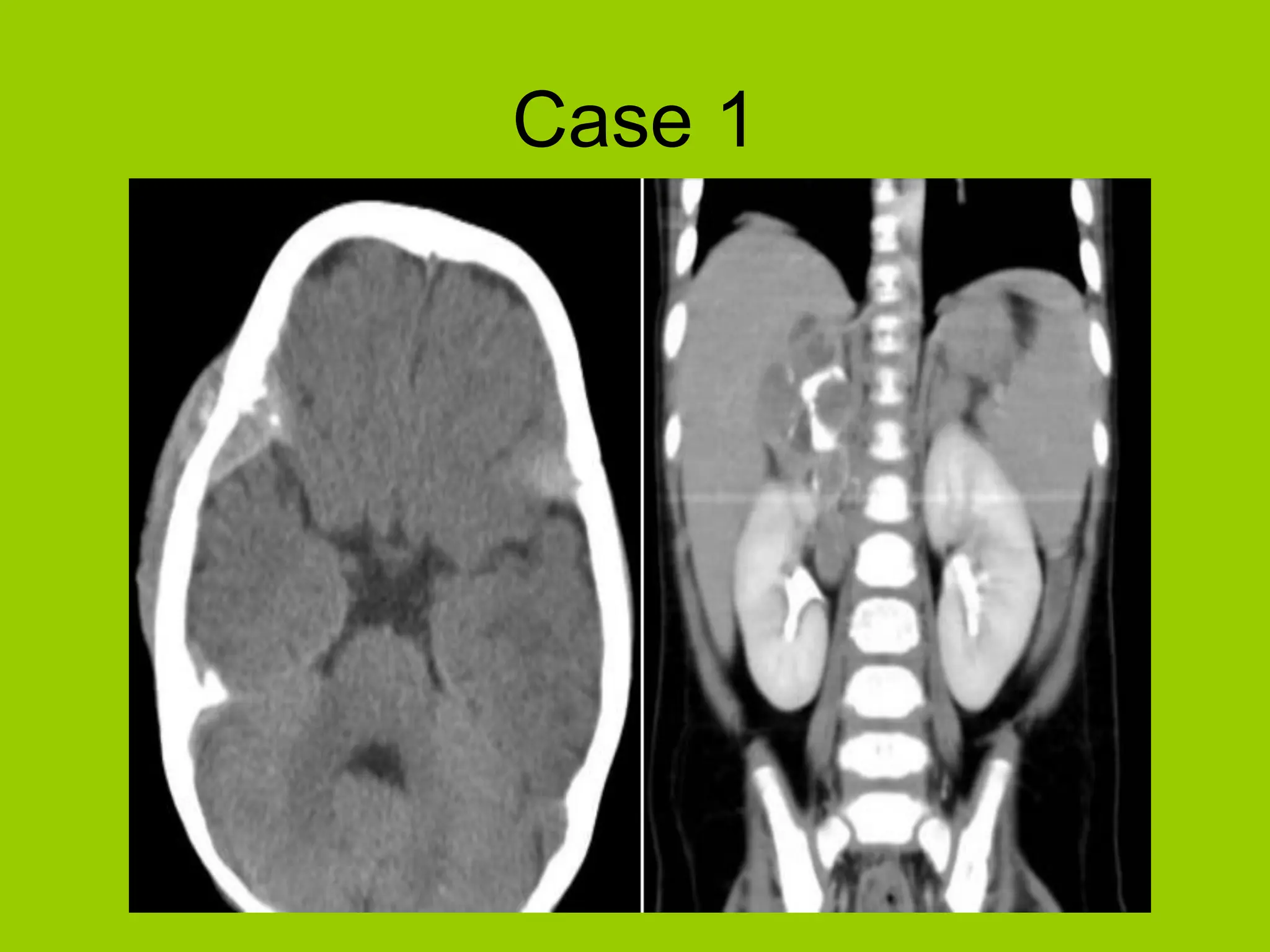 Pediatrics, Barium and Urological contrast technique Revision cases.pdf