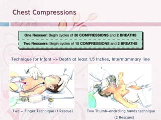 Pediatrics basic and advance life support | PPT