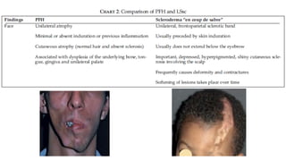 Pediatric scleroderma how to diagnosis .pptx