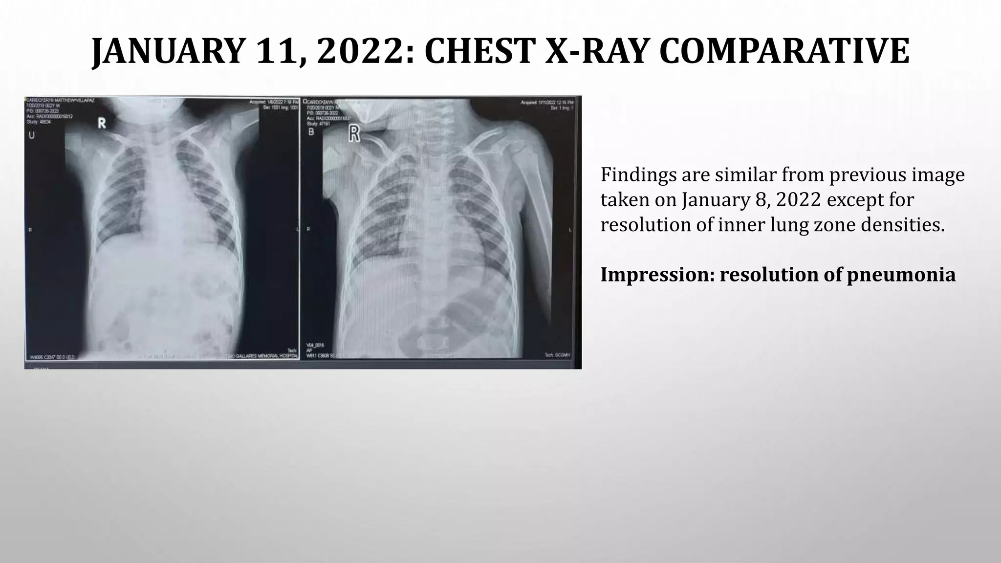 Pediatrics Community Acquired Pneumonia case study.pptx
