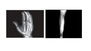 Pediatrics Congenital. & Devp. Conditions | PDF