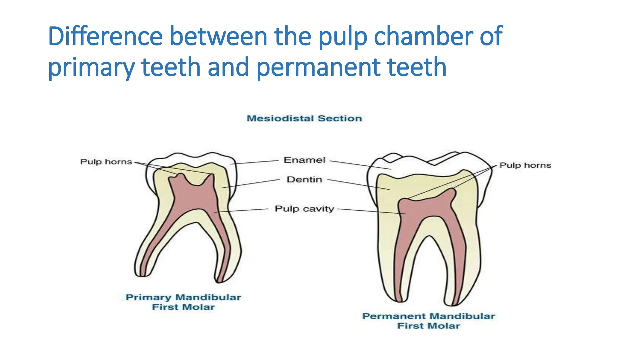 pediatrics dentistry.pptx(It is about pulp canal morphology of ...