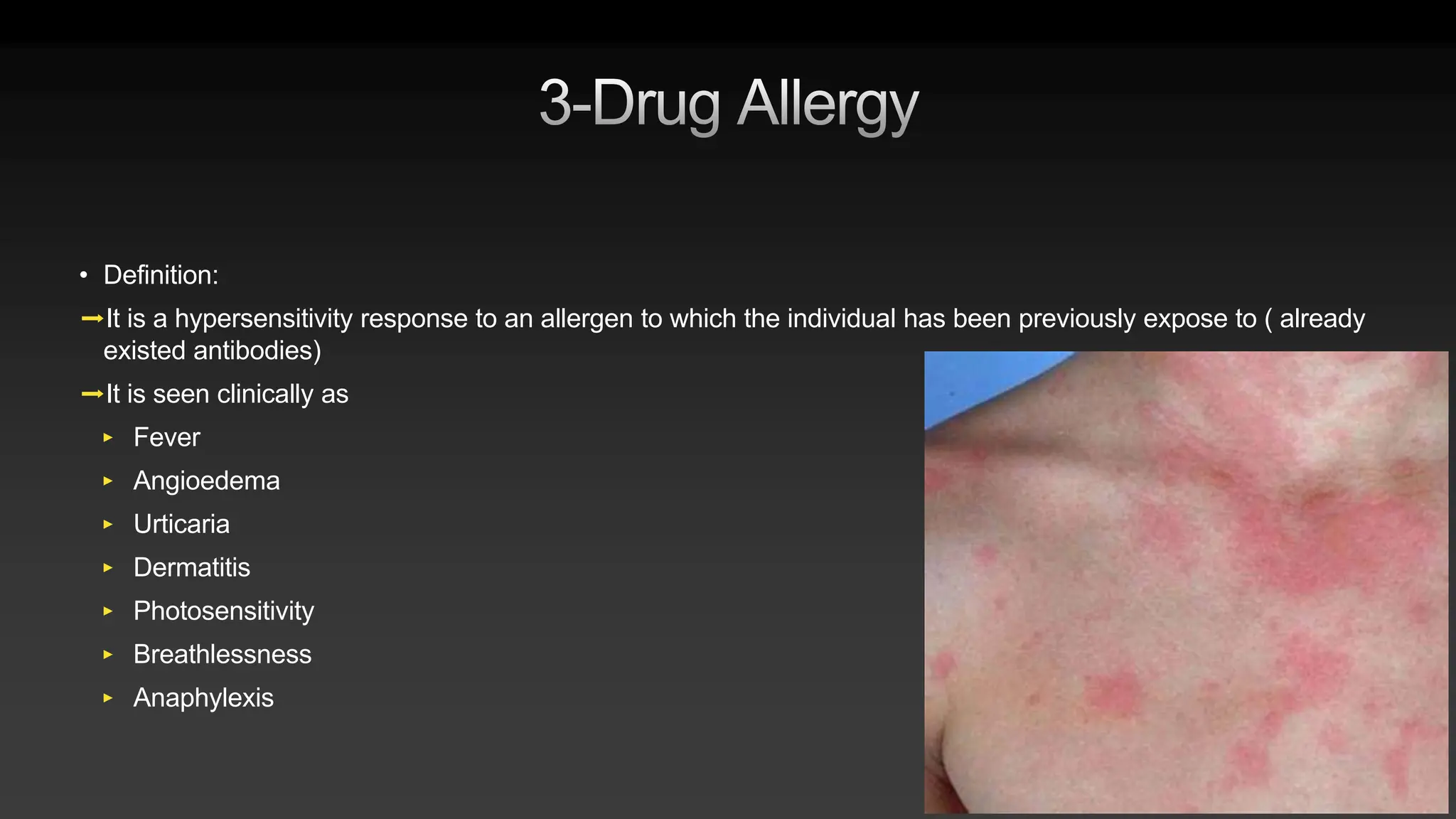 PEDIATRICS DRUG DOSES CALCULATIONS AND COMMON DRUG REACTIONS .pptx