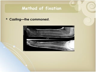 PEDIATRICS FRACTURES IN CHIDLRENS ORTHO.pptx