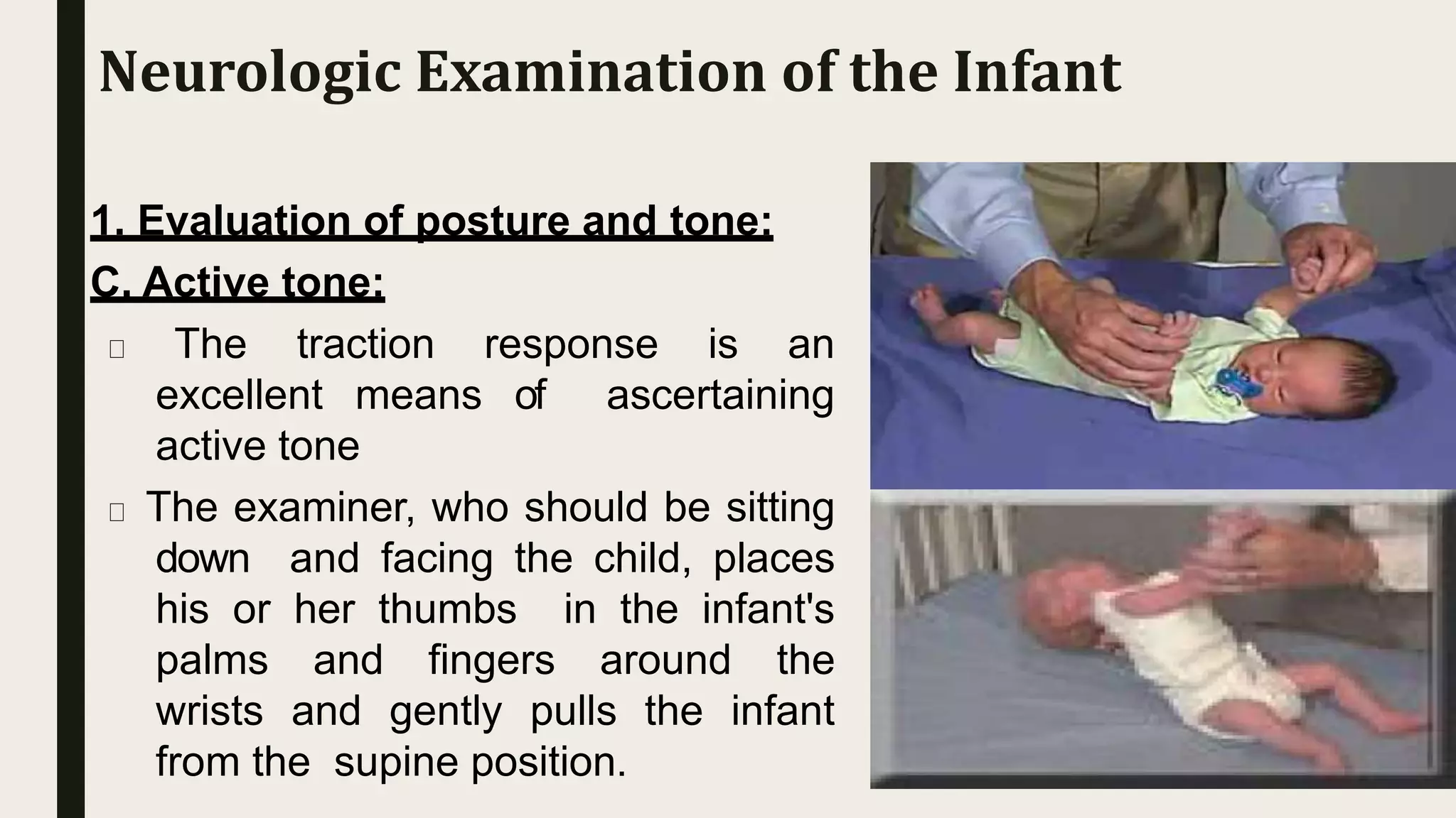 Pediatrics Neurological Examination.pptx