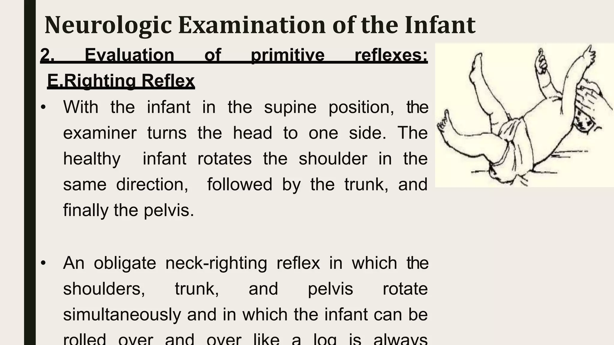 Pediatrics Neurological Examination.pptx