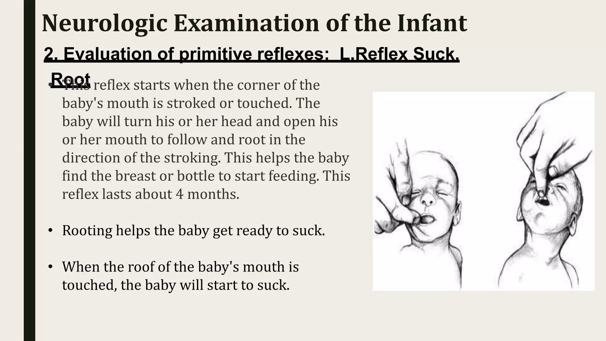 Pediatrics Neurological Examination.pptx